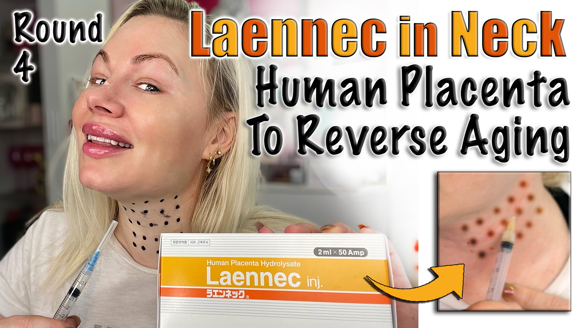 Human Placenta in the neck | Laennec | Curacen